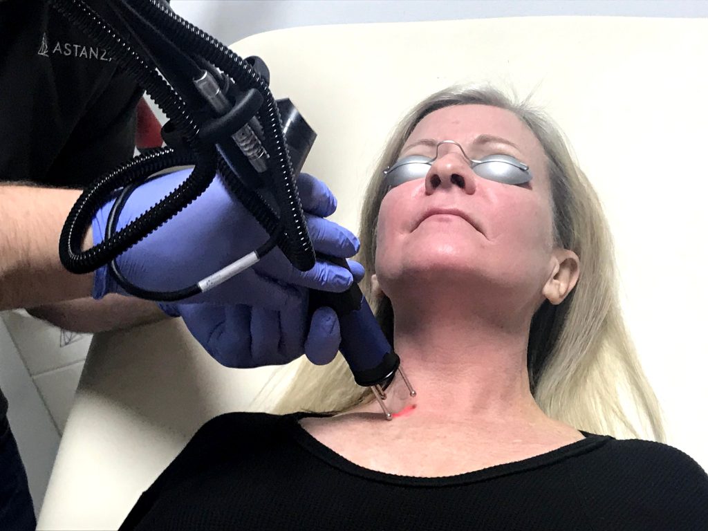 Laser Skin Resurfacing - Nova Skin Laser & Wellness